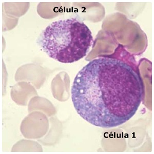 @Nãotemmaisfim@: Mielócitos